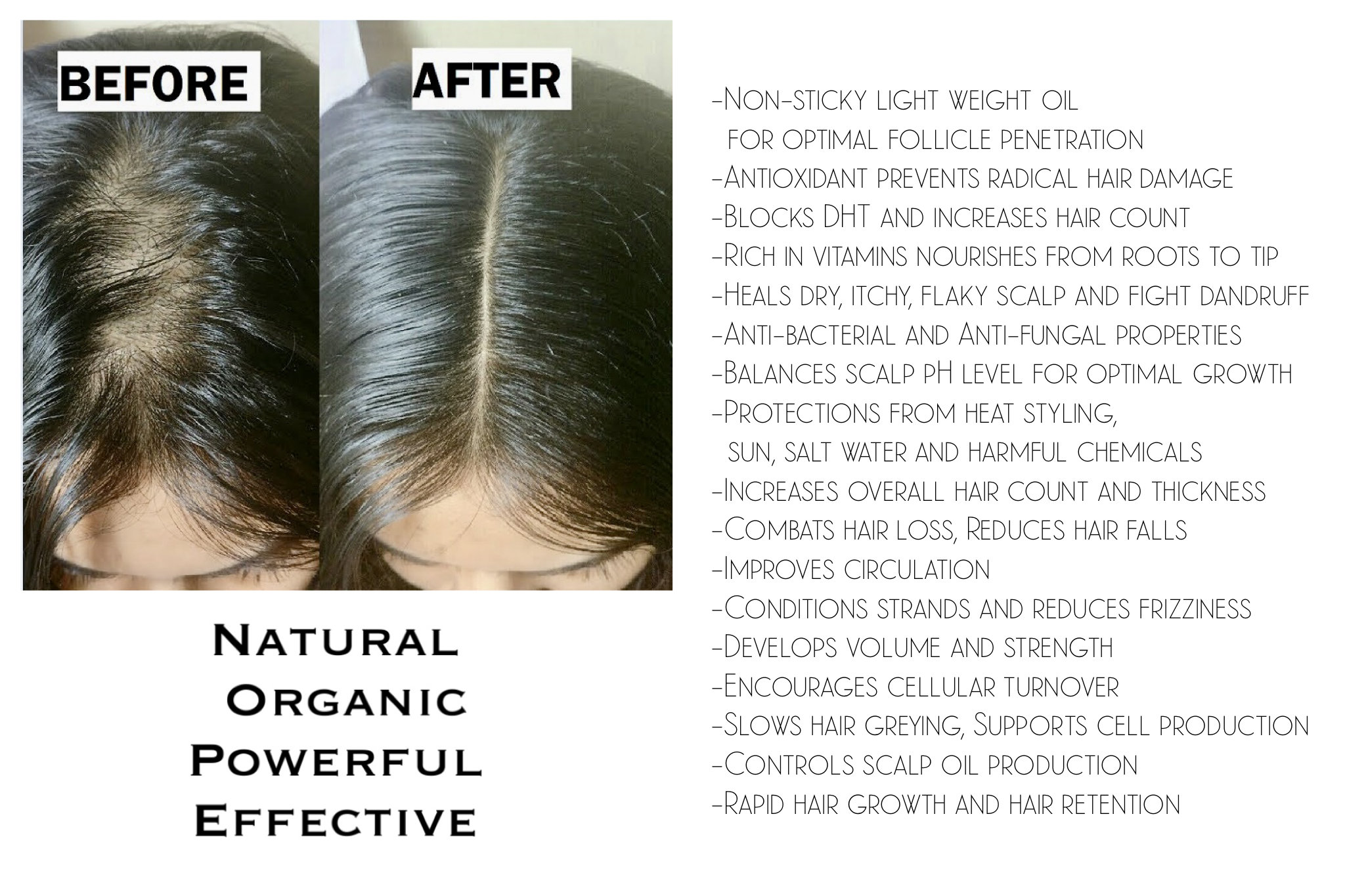 Hair Growth Spray Rosemary Hair Spray Clove Hair Spray Fast - Etsy