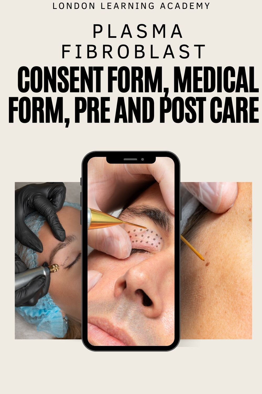 Professional Plasma Fibroblast Consent & Care Forms / Medical Form for ...