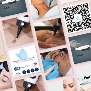 Cryopen Therapy Manual EDITABLE - Etsy