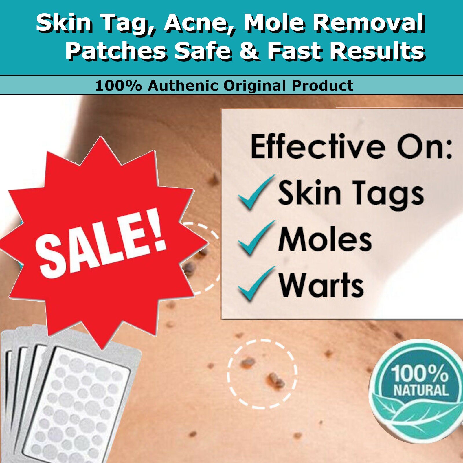 New Skin Tag Remover Patches High Quality Treatment for Moles Warts Popular - Etsy