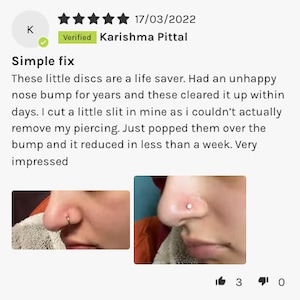 Piercing Disc for Hypertrophic Scarring by Sibj's Lobelove™ | Medical ...