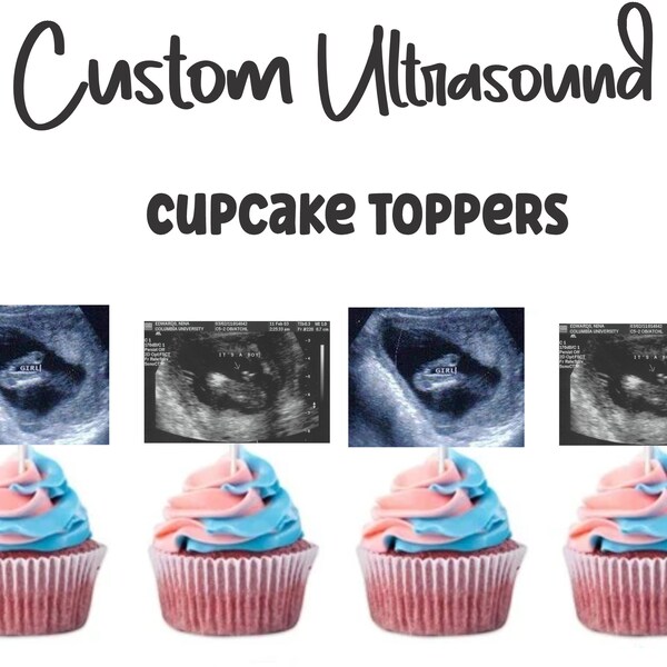 Ultrasound Cake Topper - Etsy