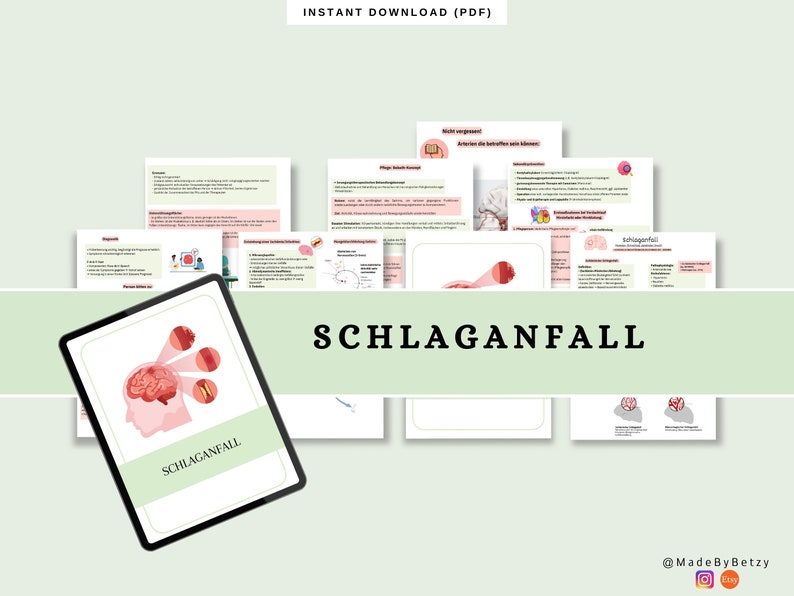 Schlaganfall/Apoplex Lernzettel PflegeAusbildung Inhalt Medizin - Etsy.de