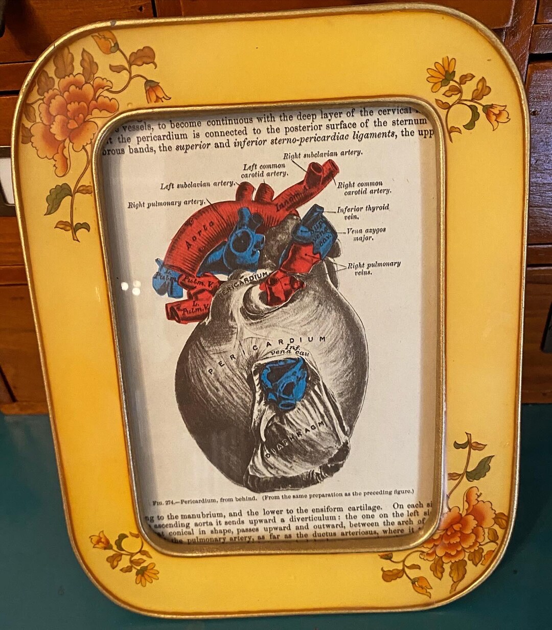 Anatomical Heart in Vintage Frame - Etsy