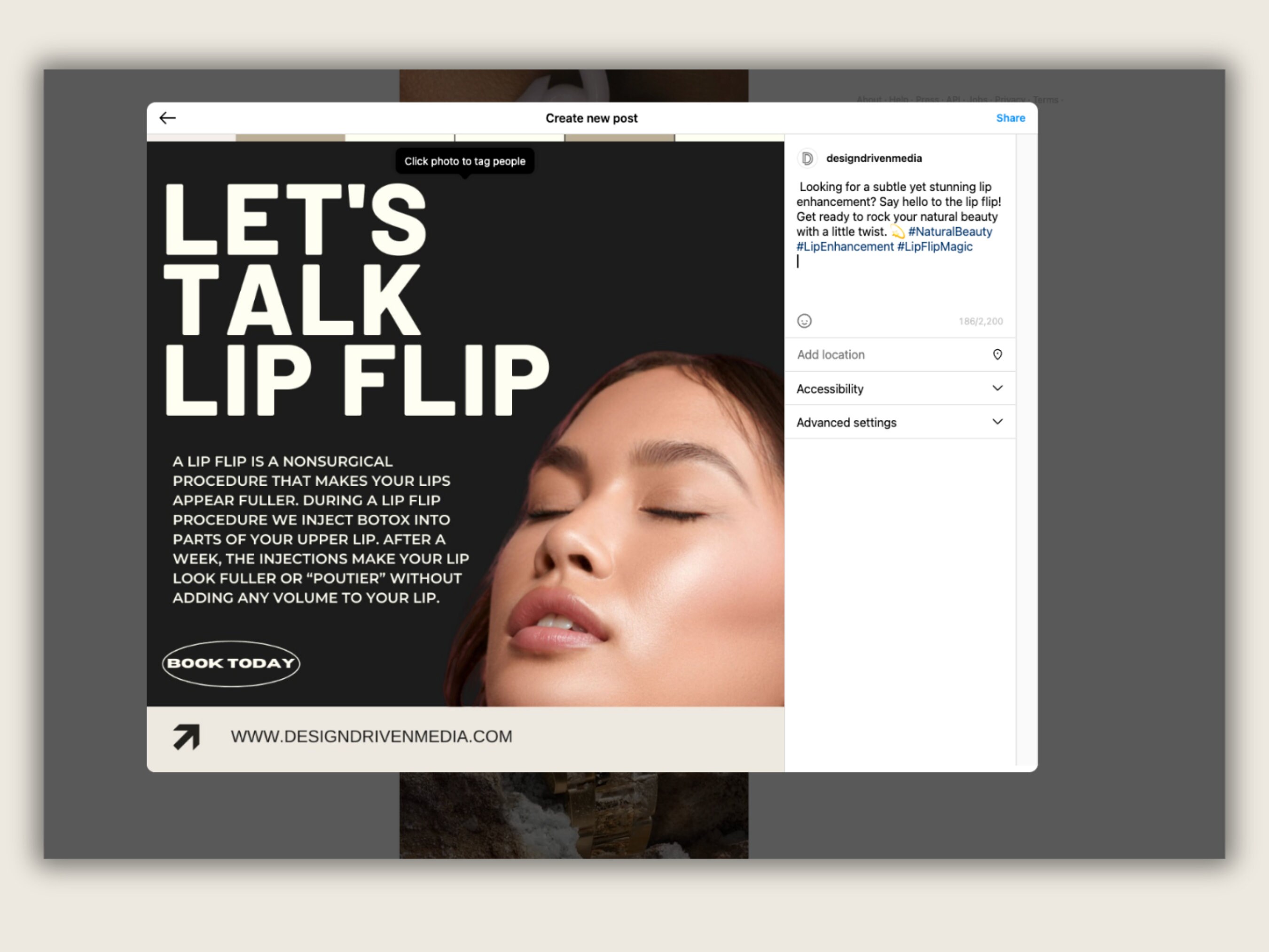 Botox and Filler Instagram Template Nurse Injector Captions - Etsy UK