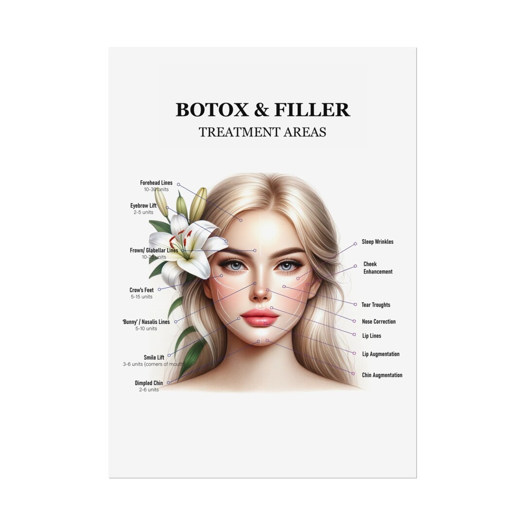 Botox and Filler Treatment Area Rolled Poster, Facial Anatomy Muscles ...