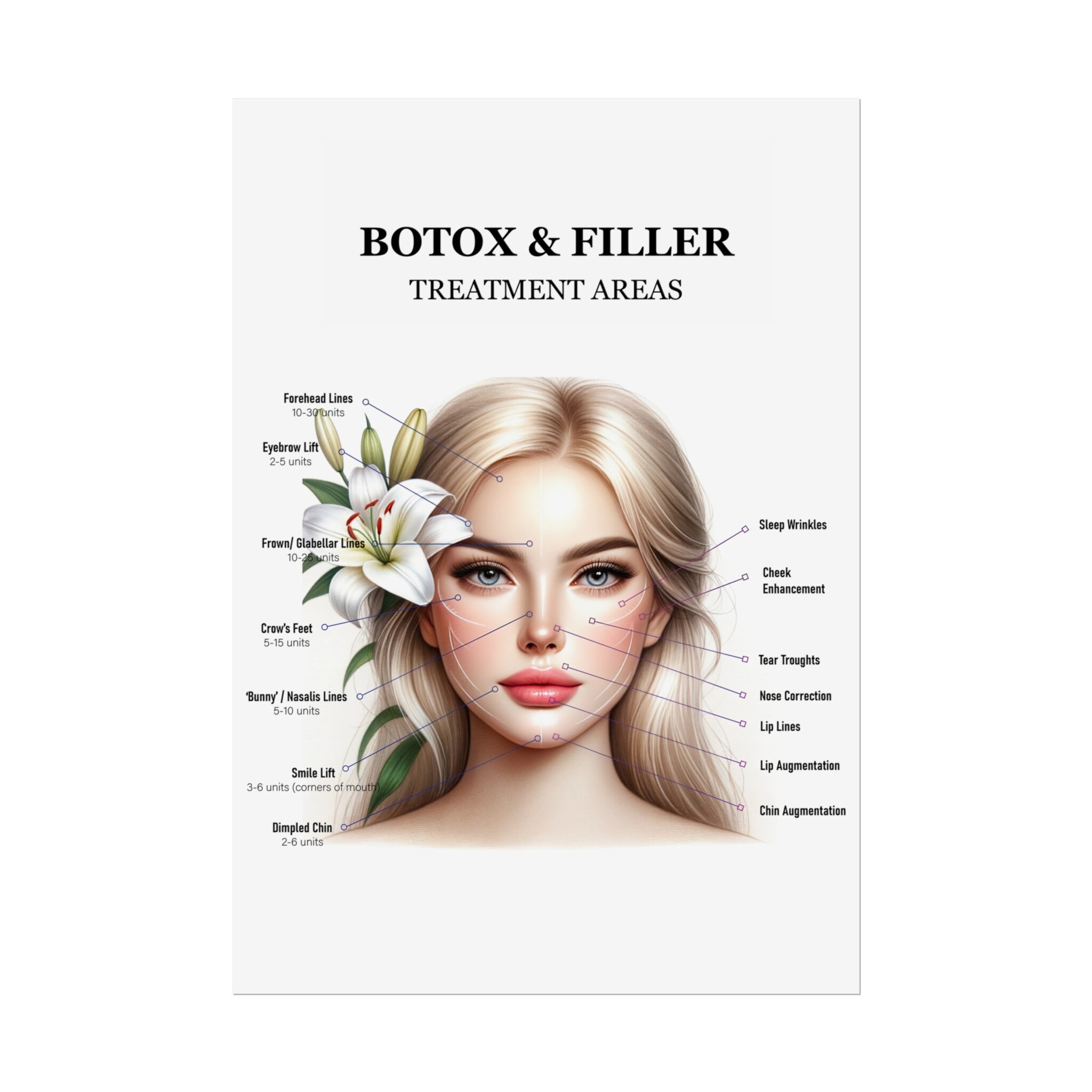 Botox and Filler Treatment Area Rolled Poster, Facial Anatomy Muscles ...