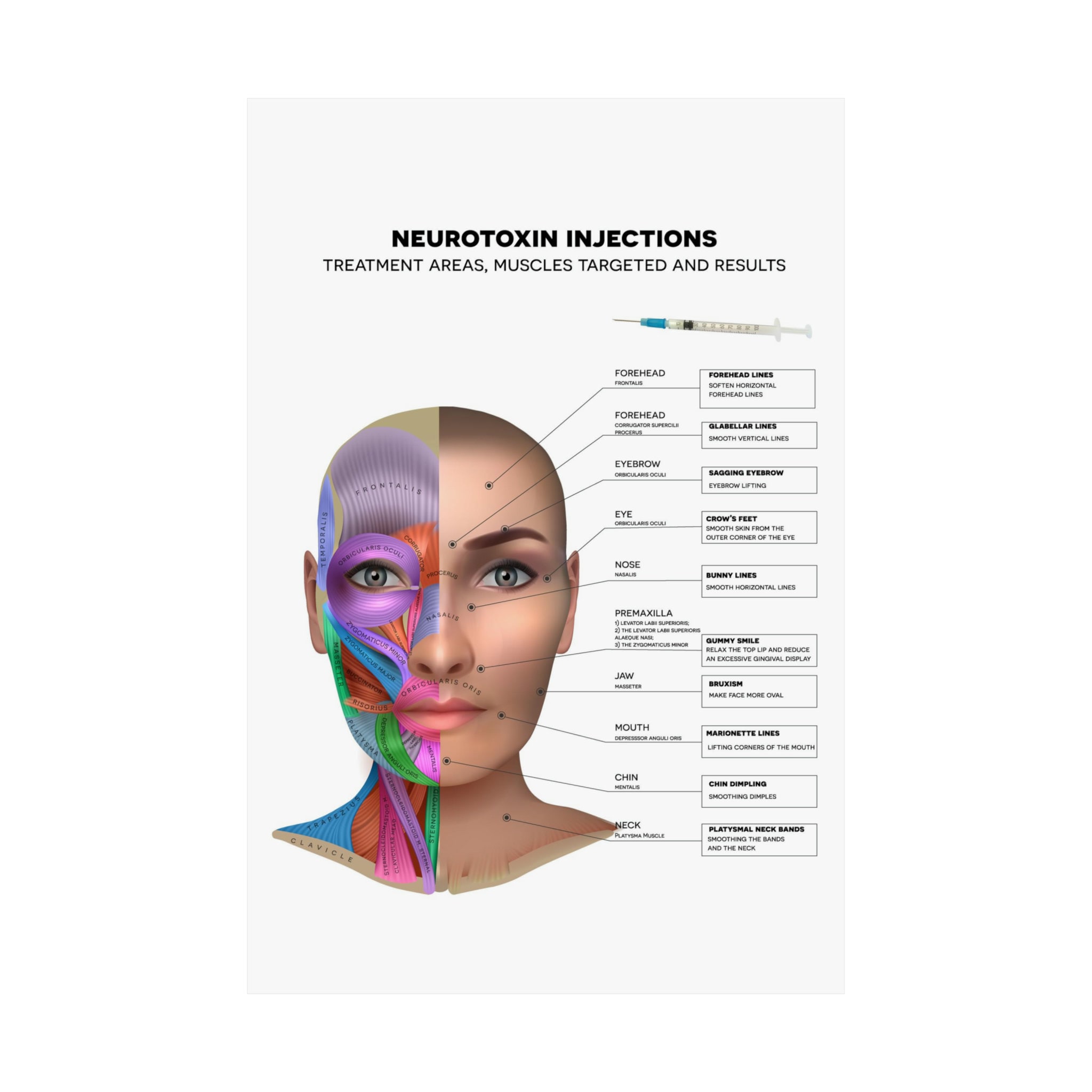 Neurotoxin Injections Treatment Areas, Muscles Targeted, Results ...