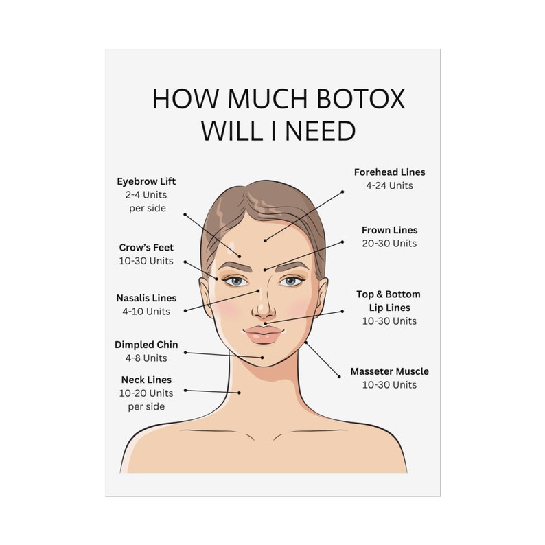 How Much Botox Will I Need Rolled Poster, Facial Anatomy Muscles Rolled ...