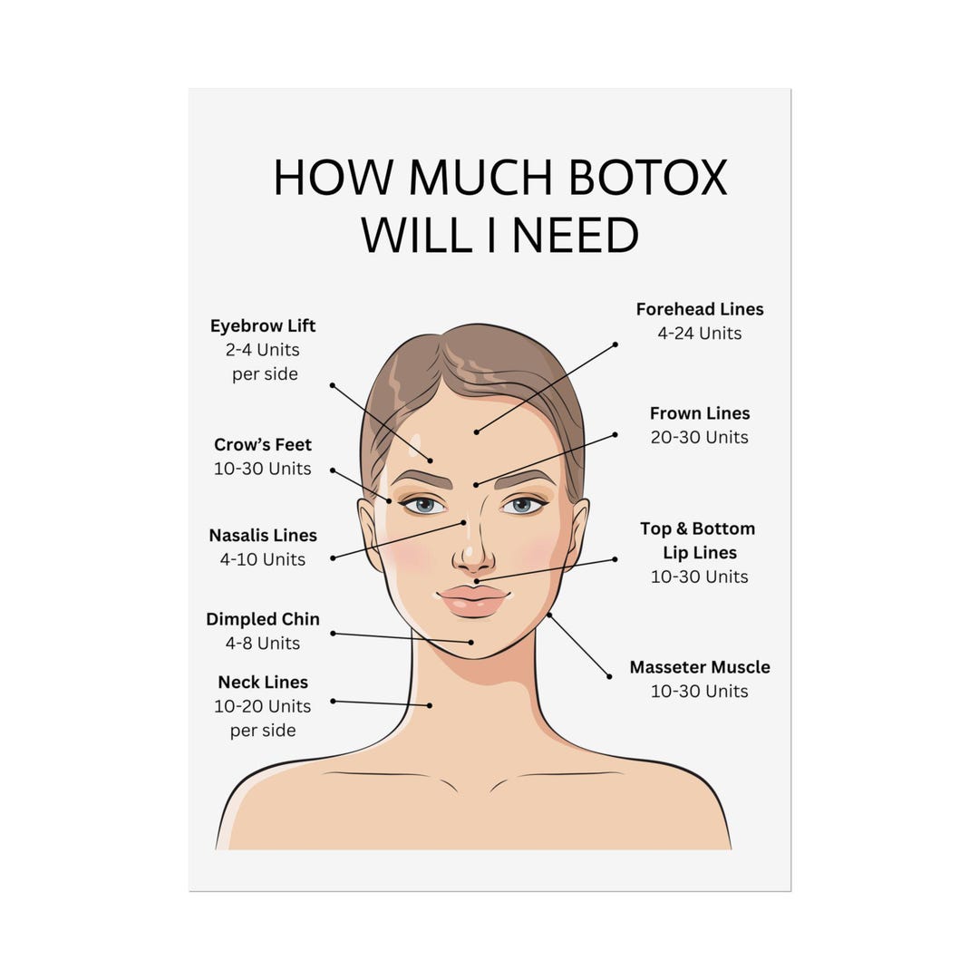 How Much Botox Will I Need Rolled Poster, Facial Anatomy Muscles Rolled ...