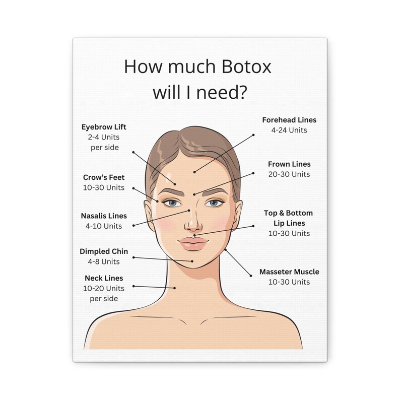 How Much Botox Will I Need? - Matte Canvas, Stretched, 1.25" - Medspa ...