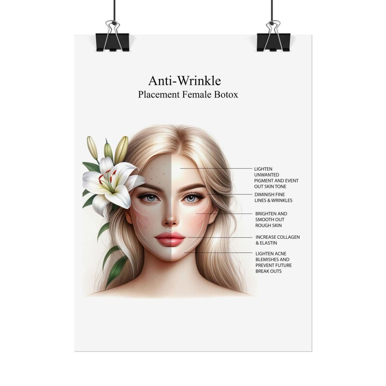 Anti-wrinkle Botox Placement Areas Rolled Poster, Facial Anatomy ...