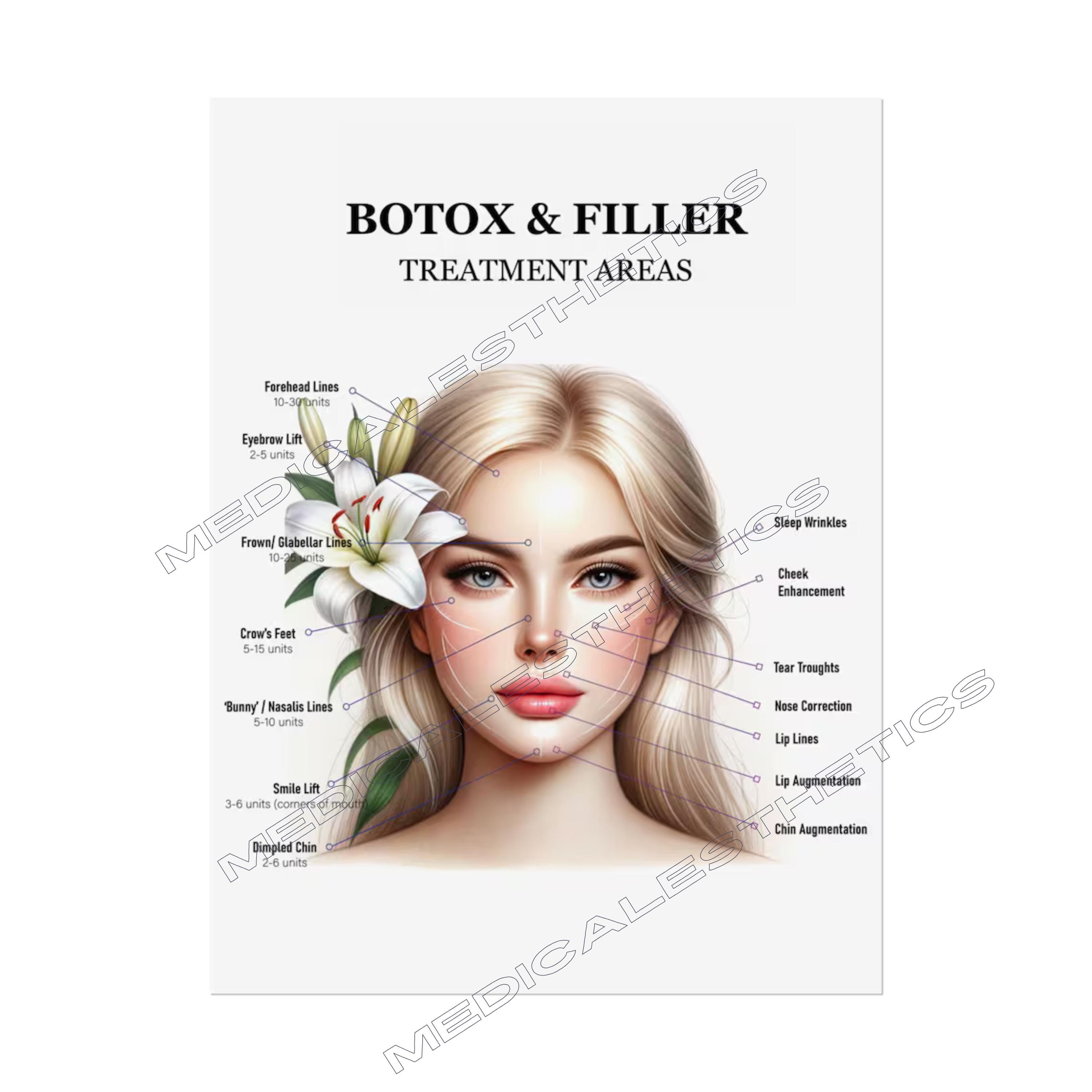 Botox and Filler Treatment Area Rolled Poster, Facial Anatomy Muscles ...