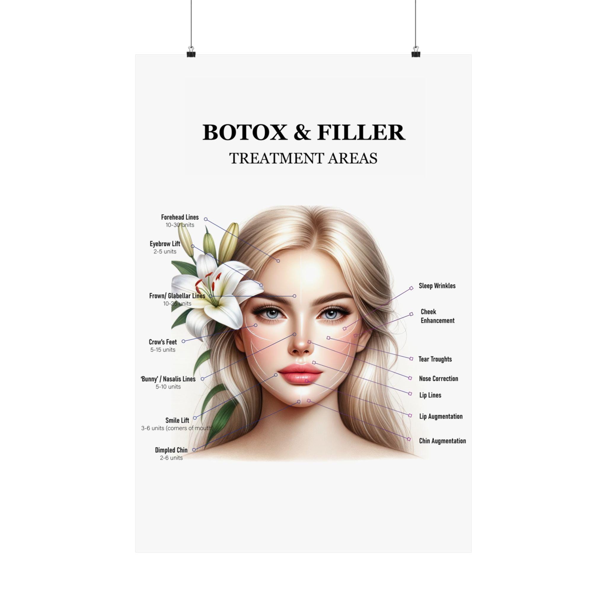 Botox & Filler Treatment Area Poster, Med Spa Decor - Etsy
