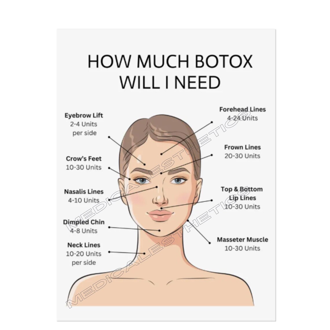 How Much Botox Will I Need Rolled Poster, Facial Anatomy Muscles Rolled ...