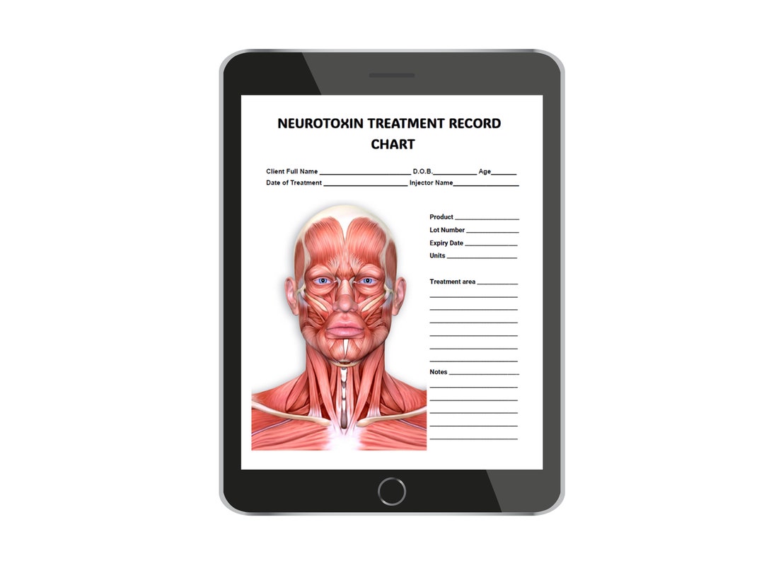 Neurotoxin Treatment Plan Chart Male Version, Nurse Injector ...