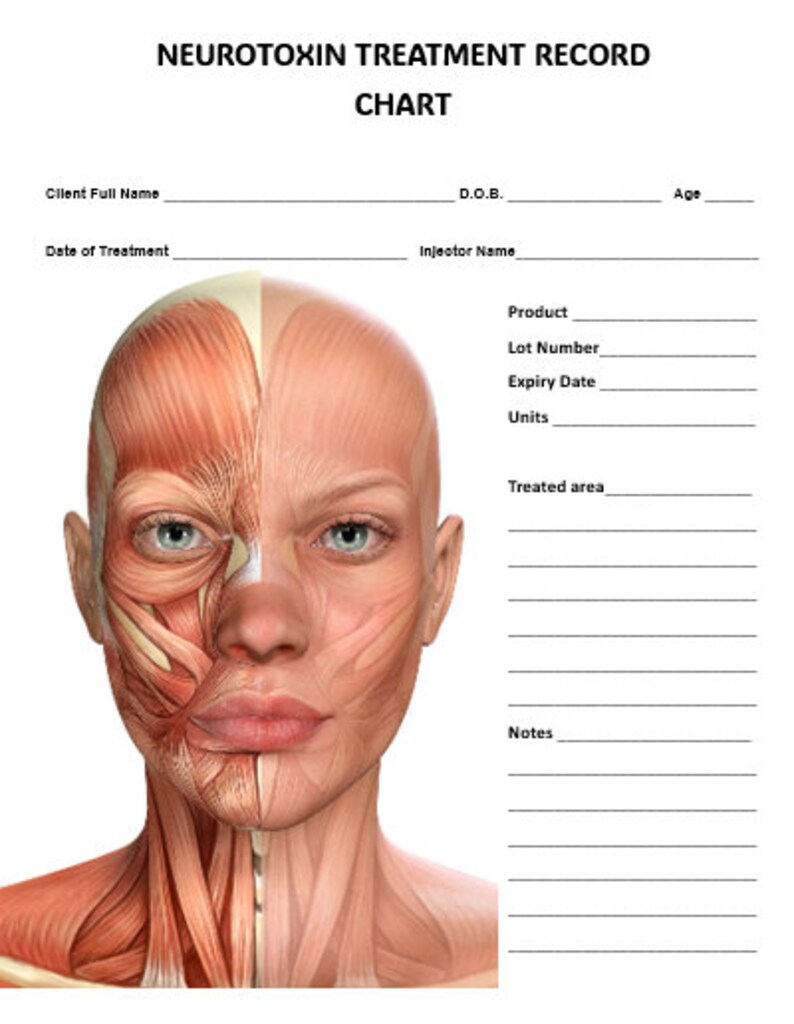 Neurotoxin Treatment Record Chart, Nurse Injector Template, Aesthetic ...