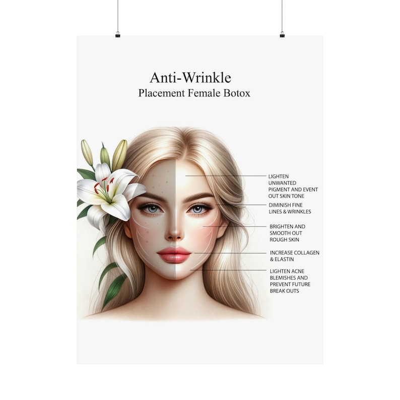 Customized Anti-wrinkle Botox Treatment Poster, Med Spa Decor - Etsy