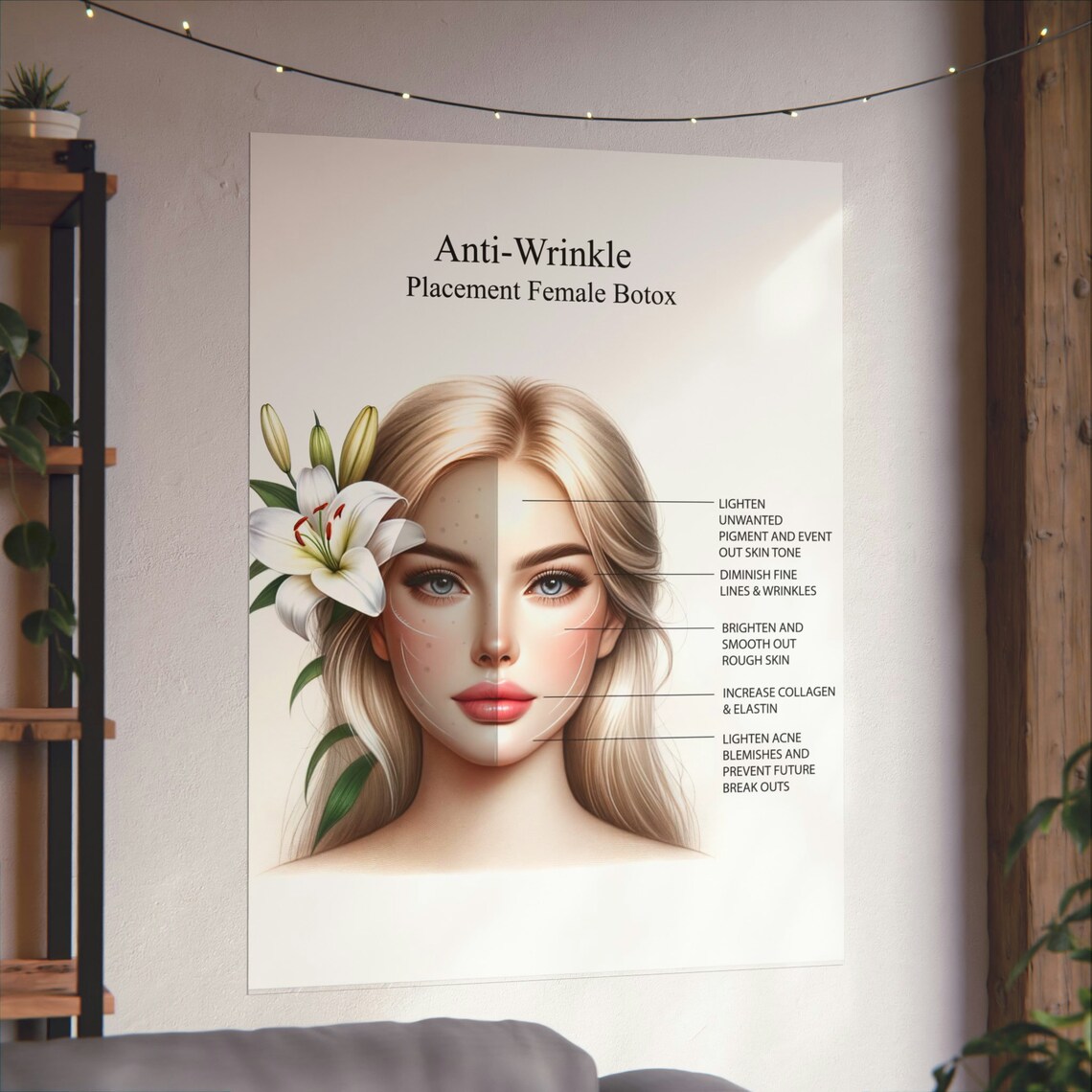Customized Anti-wrinkle Botox Treatment Poster, Med Spa Decor - Etsy