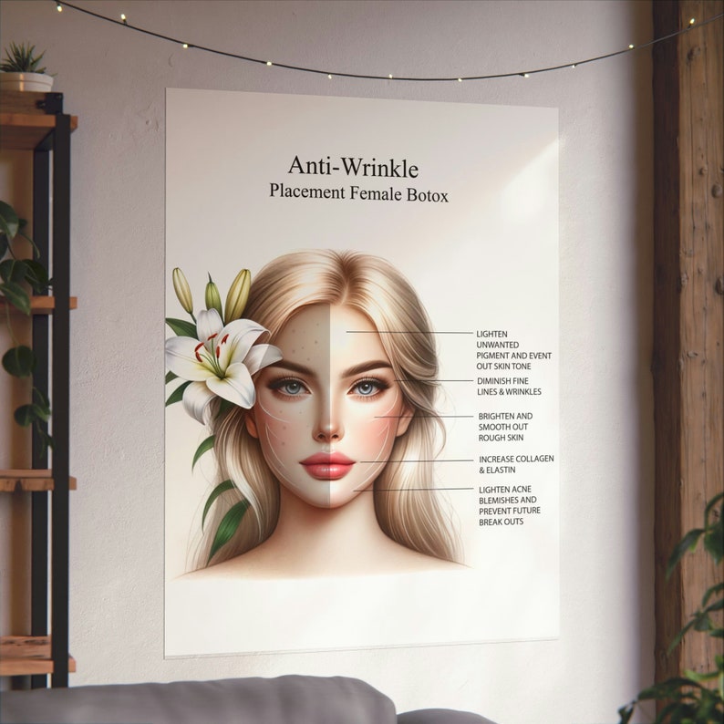 Customized Anti-wrinkle Botox Treatment Poster, Med Spa Decor - Etsy