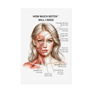 Facial Anatomy Muscles Rolled Poster, How Much Botox Will I Need Poster ...