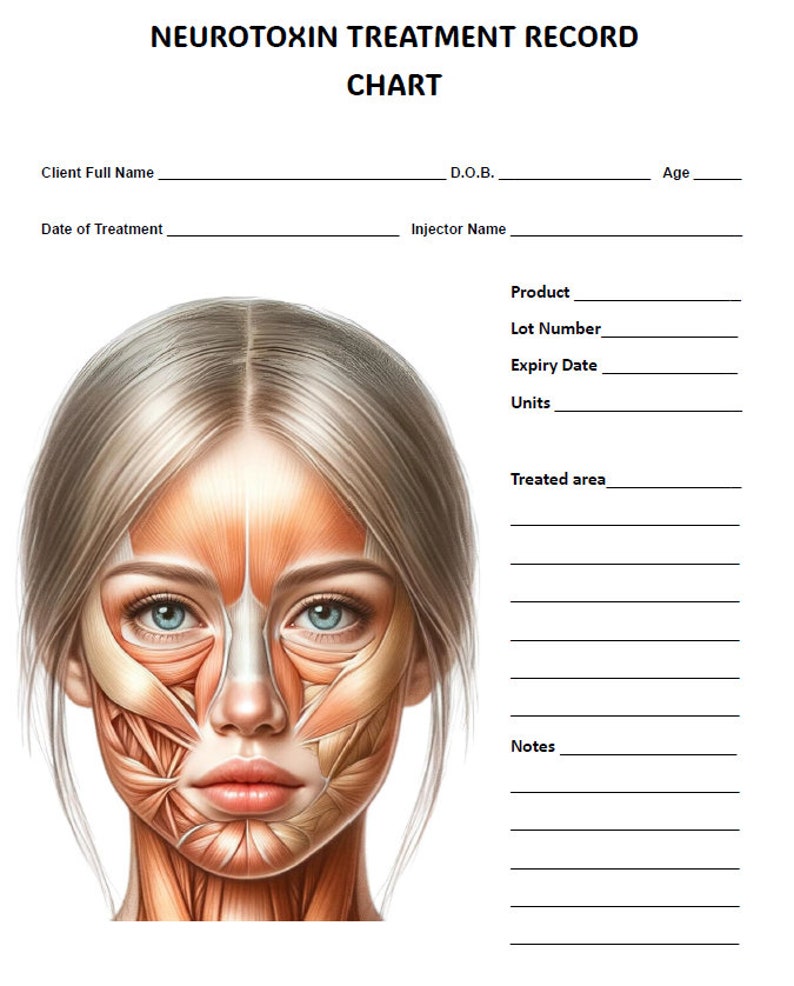 Neurotoxin Treatment Record Chart Female Version, Nurse Injector ...