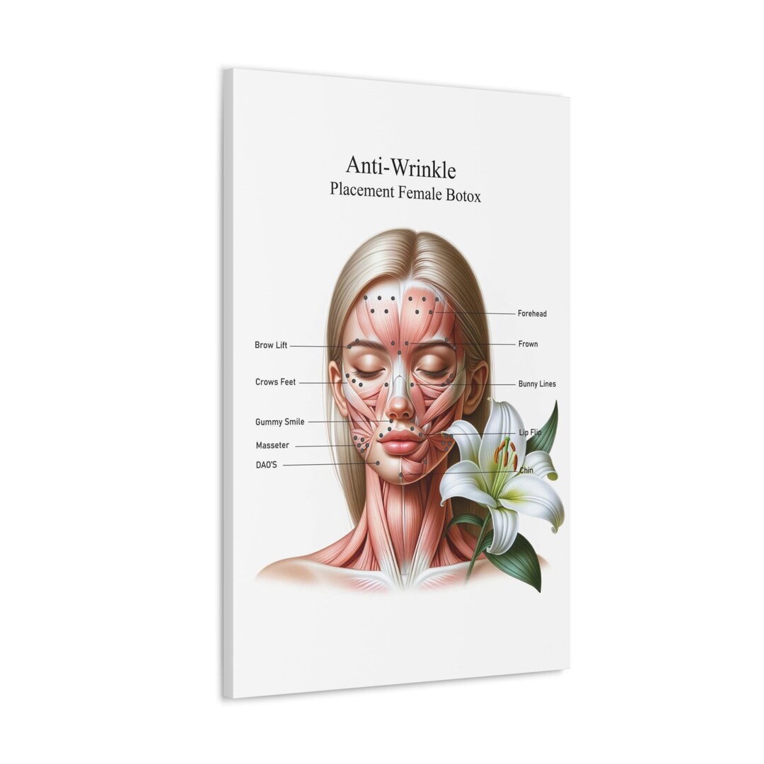 Customized Botox Placement Canvas, Face Anatomy Art Canvas, Medical Spa ...