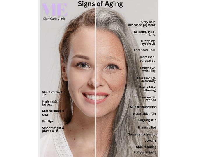 Signs of Facial Aging Rolled Poster, Med Spa Poster, Esthetician Wall ...