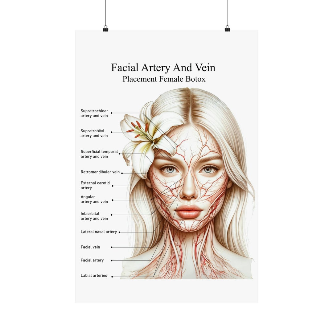 Facial Artery and Veins Poster, Botox Treatment Poster, Med Spa Decor ...