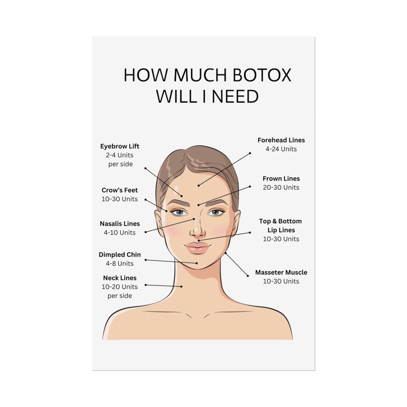 How Much Botox Will I Need Rolled Poster, Facial Anatomy Muscles Rolled ...
