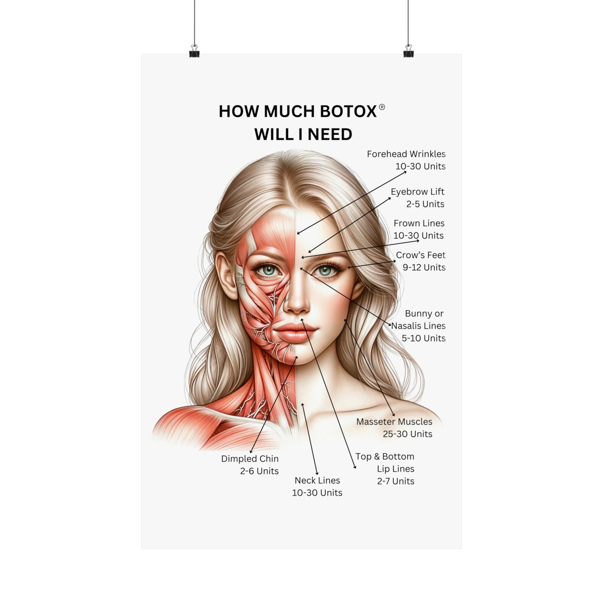 Botox Treatment Poster, How Much Botox Will I Need Female Facial ...