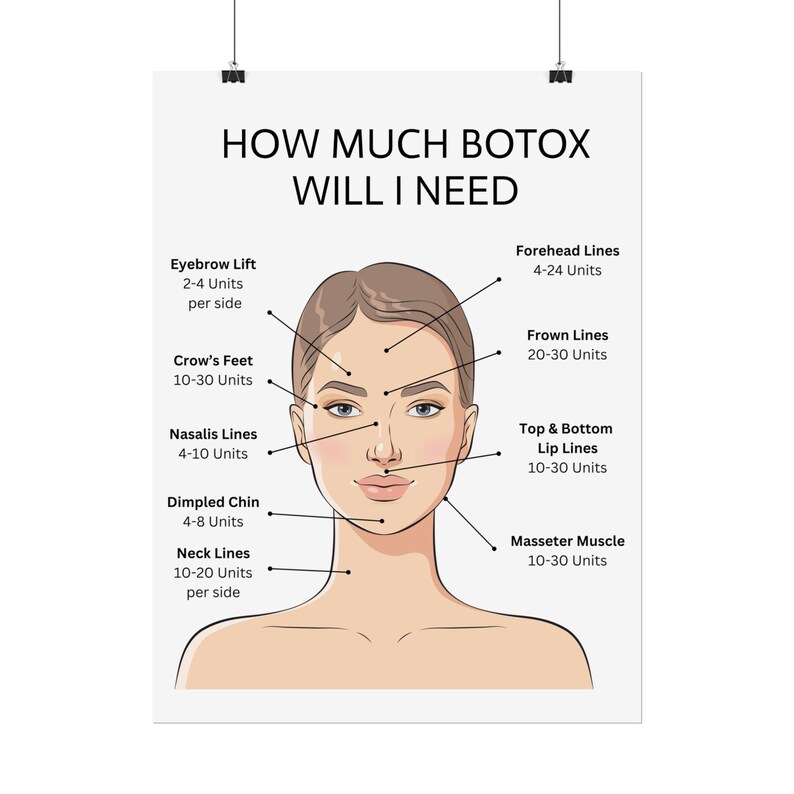 How Much Botox Will I Need Rolled Poster, Facial Anatomy Muscles Rolled ...