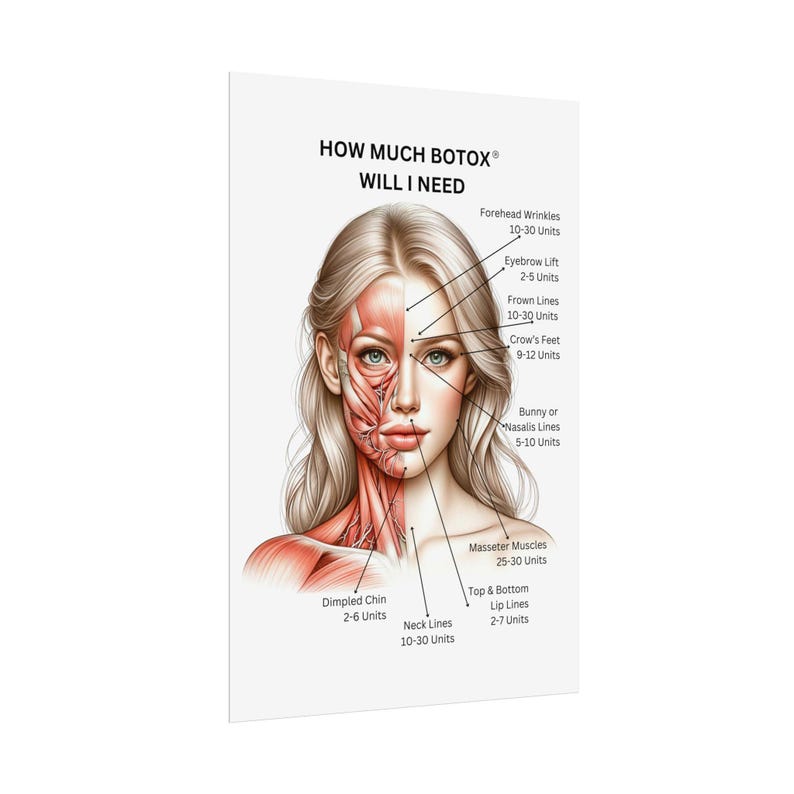Facial Anatomy Muscles Rolled Poster, How Much Botox Will I Need Poster ...
