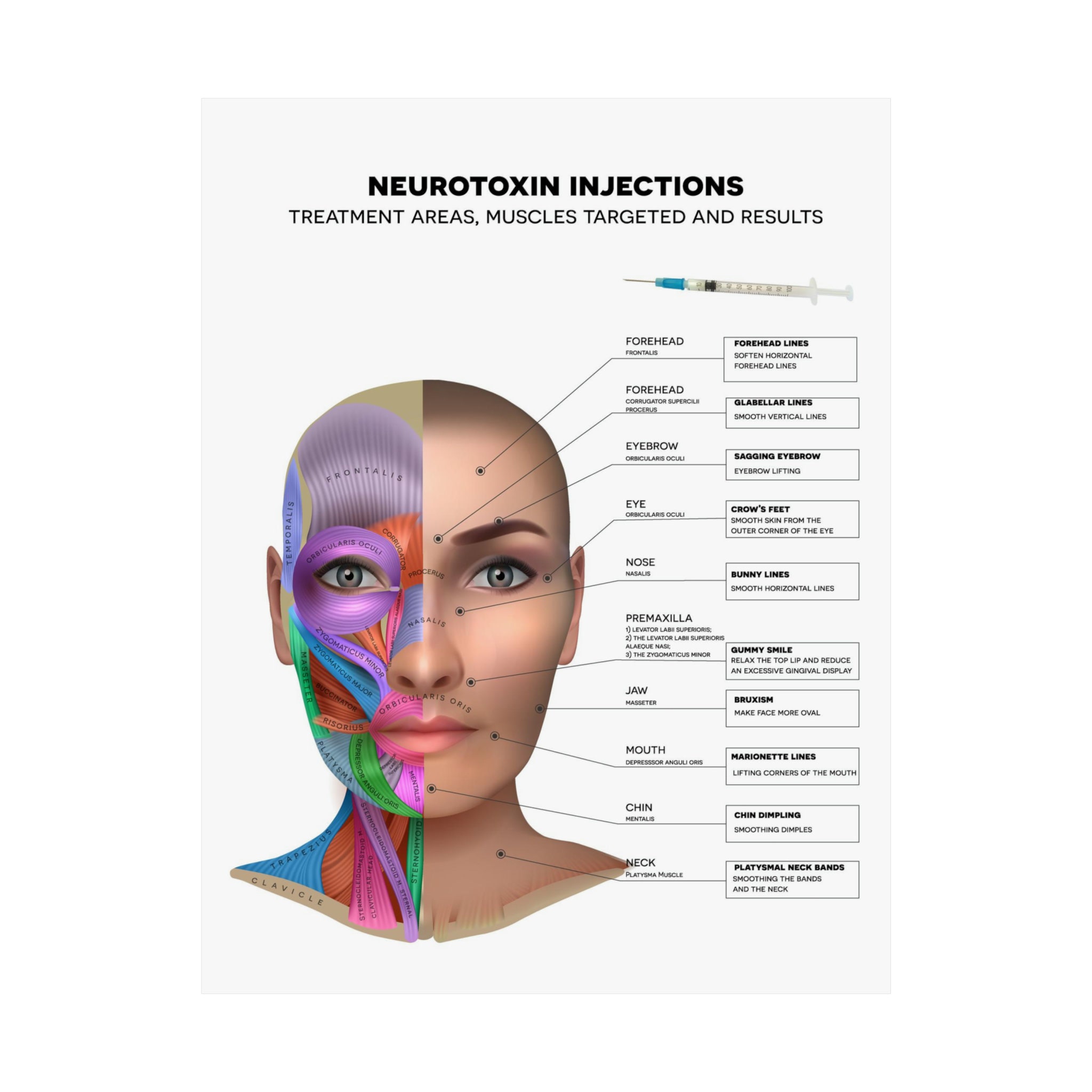 Neurotoxin Injections Treatment Areas, Muscles Targeted, Results ...