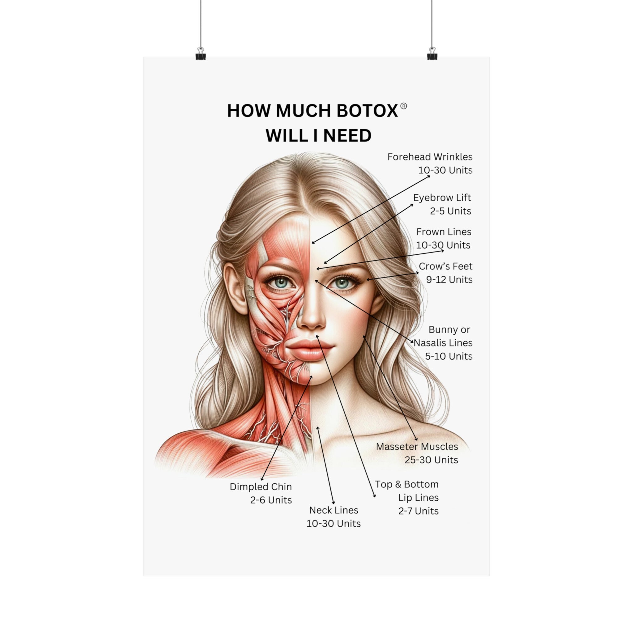 Botox Treatment Poster, How Much Botox Will I Need Female Facial ...