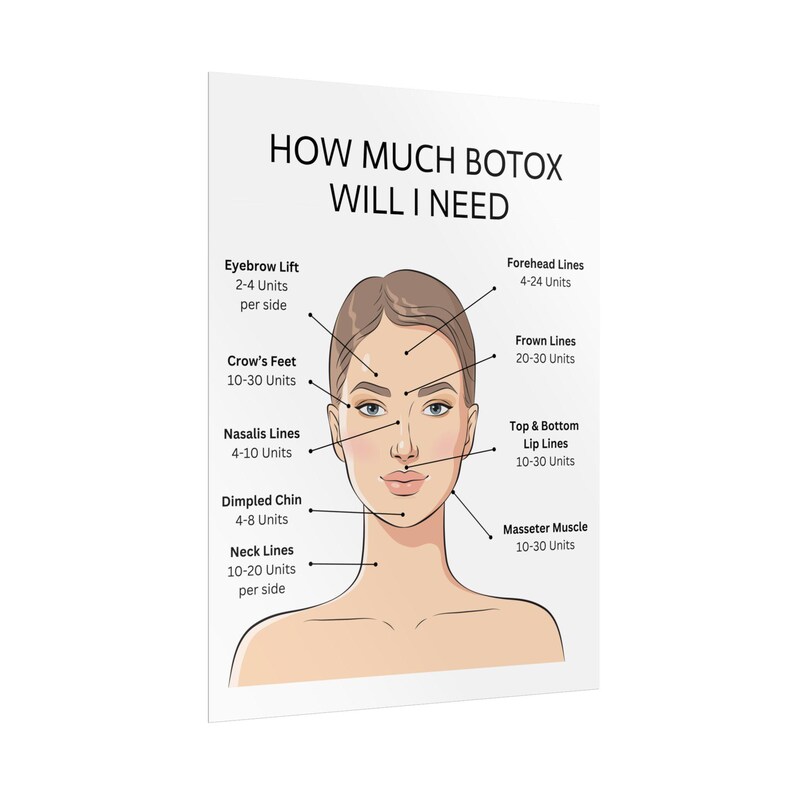 How Much Botox Will I Need Rolled Poster, Facial Anatomy Muscles Rolled ...