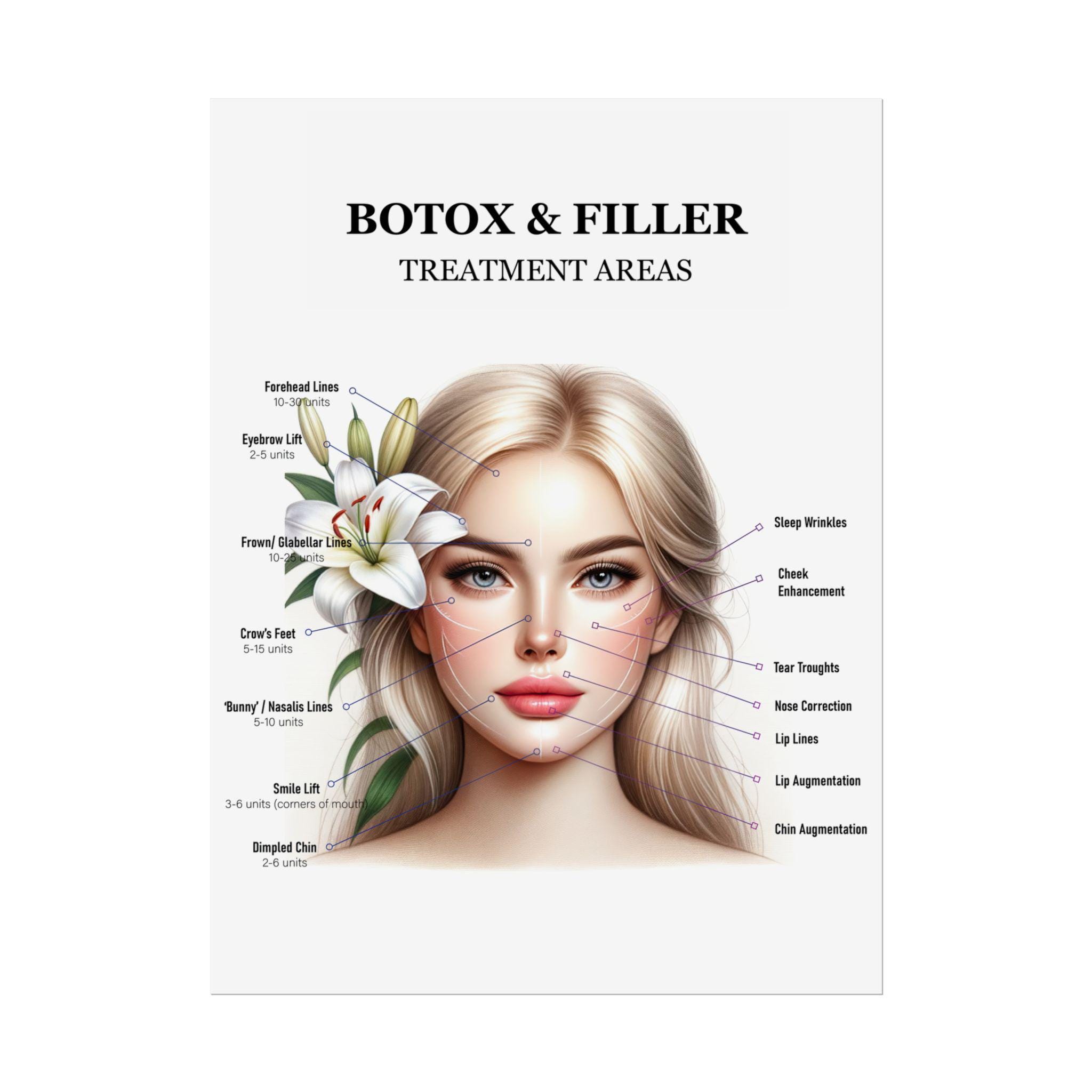 Botox and Filler Treatment Area Rolled Poster, Facial Anatomy Muscles ...