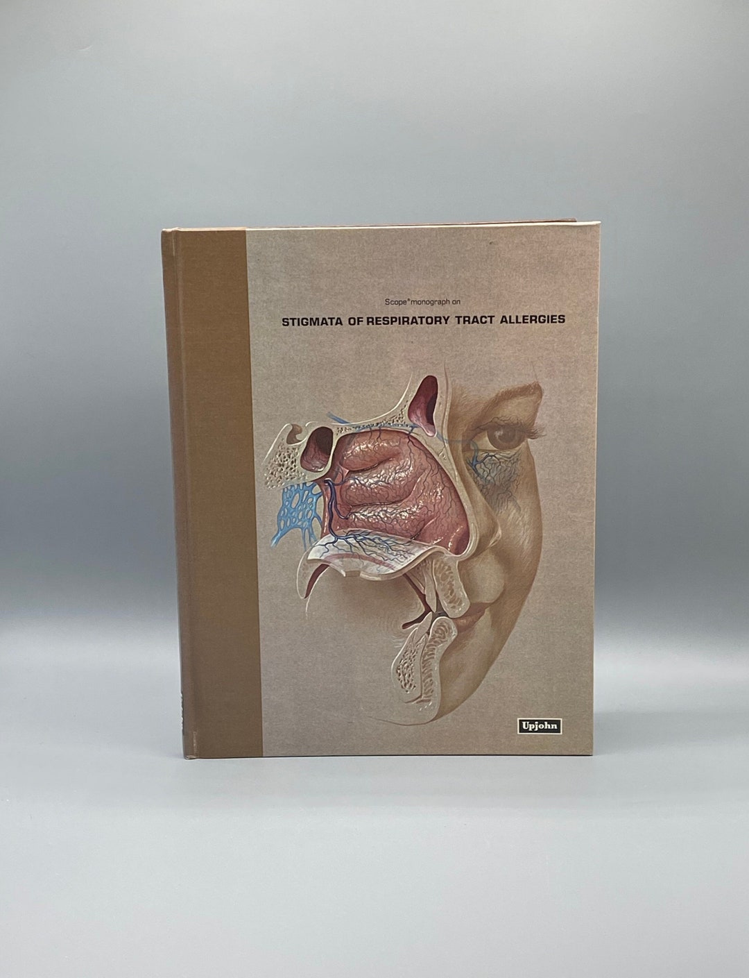 1972 Stigmata of Respiratory Tract Allergies pediatrics by Meyer B ...