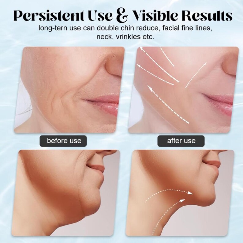 Intense Pulsed Light Facial and Neck Massager - Wrinkles Reducing ...