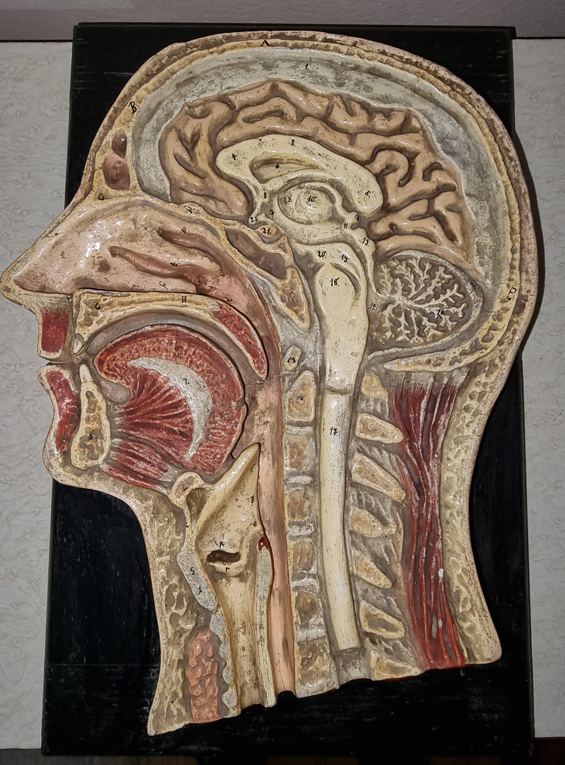 Antique Anatomical Model Somso 1890. Vintage Retro Model - Cross ...