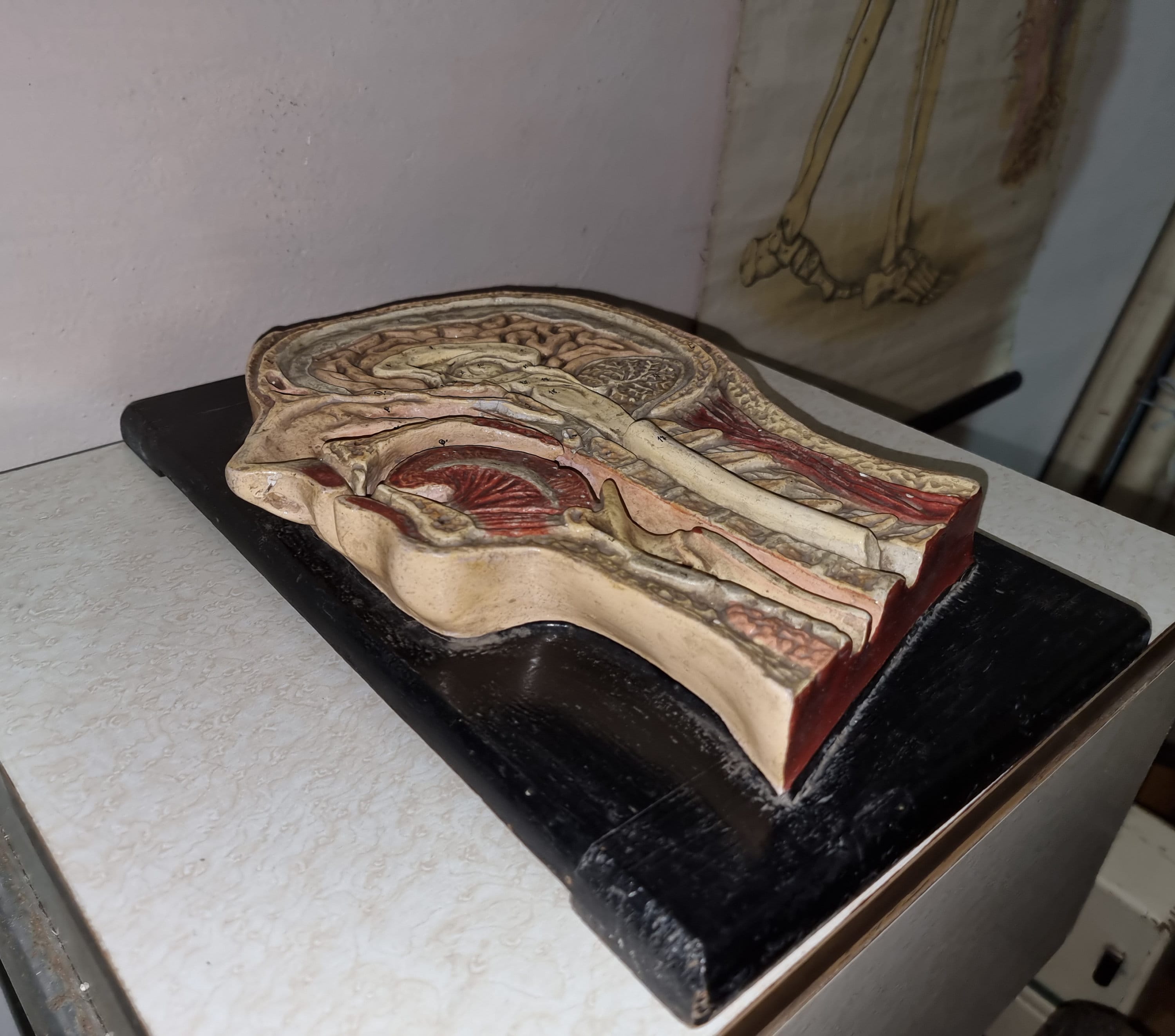 Antique Anatomical Model Somso 1890. Vintage Retro Model - Cross ...