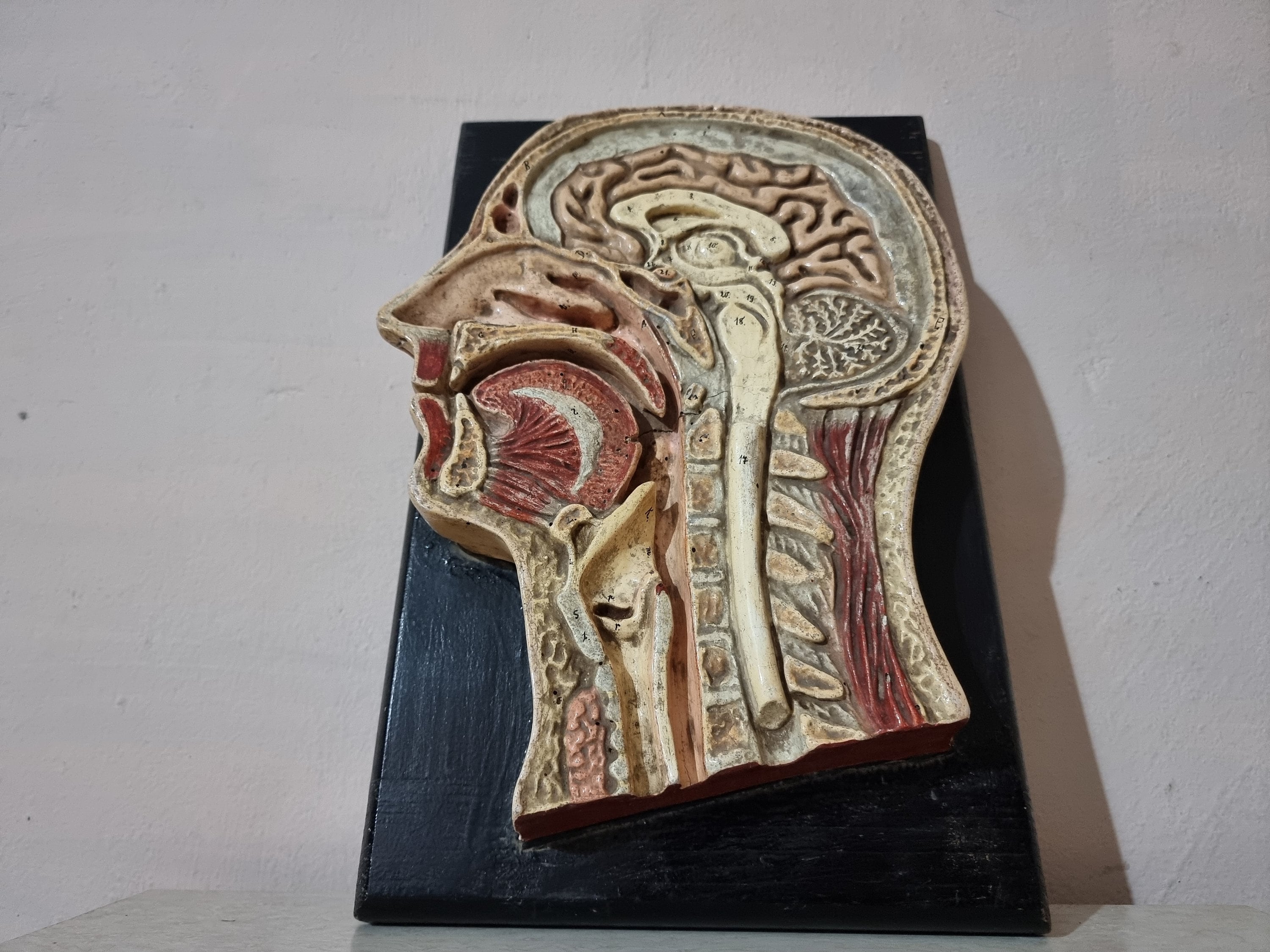 Antique Anatomical Model Somso 1890. Vintage Retro Model - Cross ...