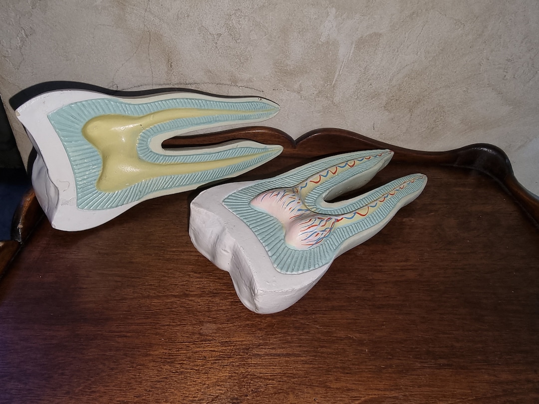 Vintage Anatomical Model Celluloid Model Human Tooth - Etsy