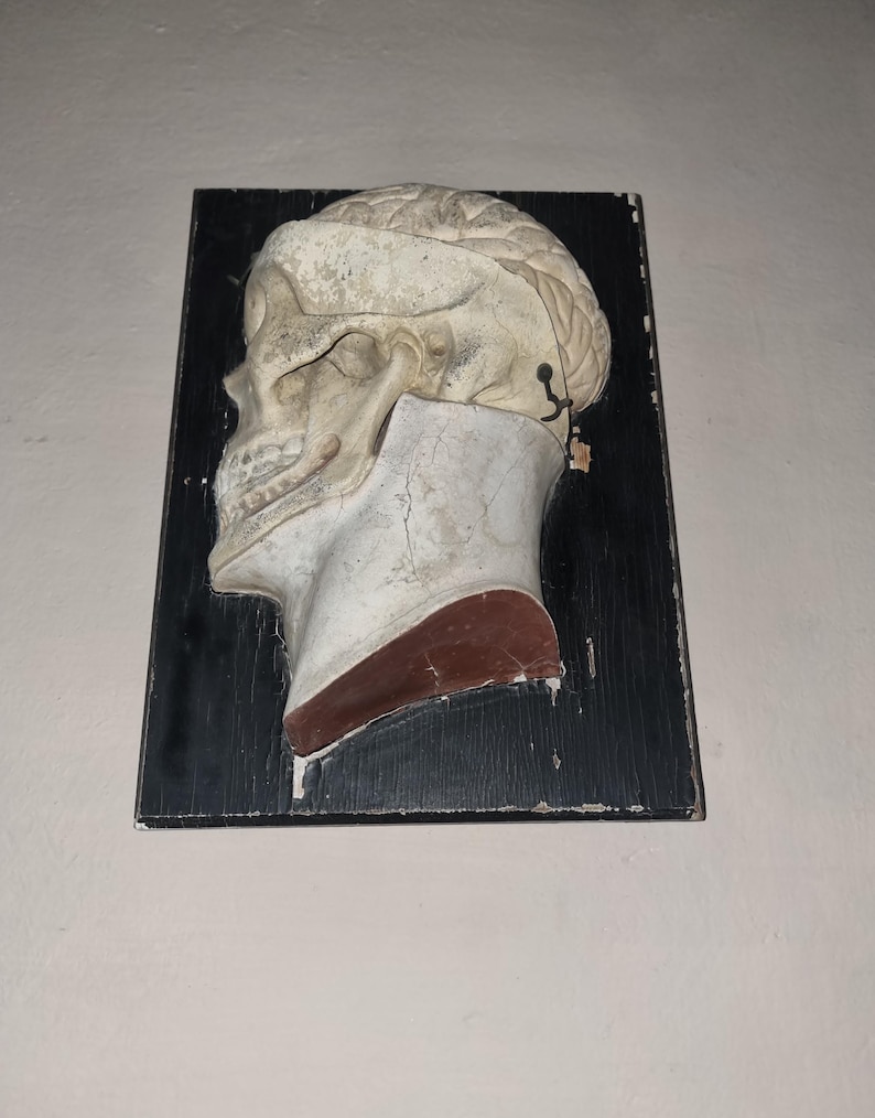 Antique Anatomical Model of a Human Head. Somso 19th Century - Etsy