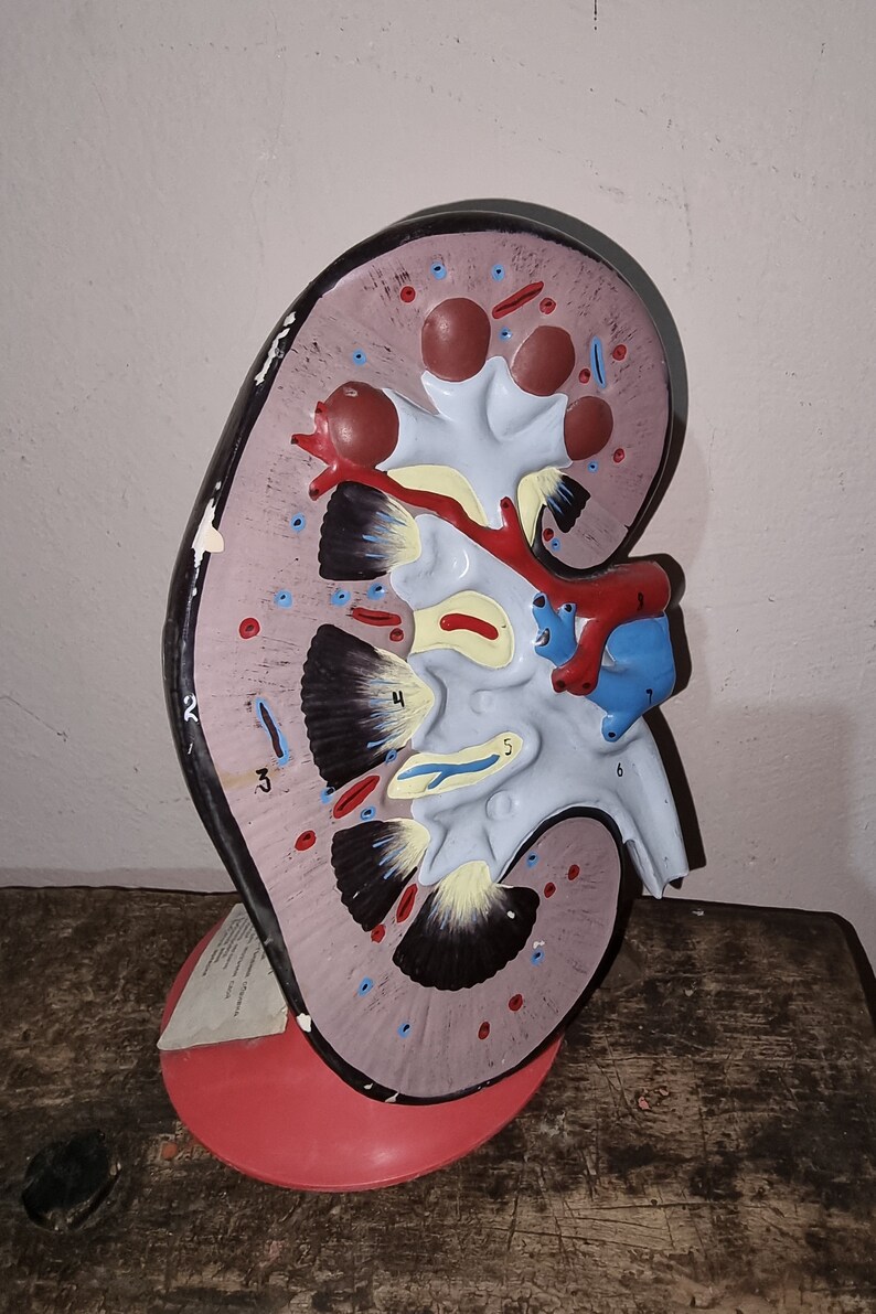 Vintage Anatomical Model of Human Kidney; Celluloid, Retro Medical ...
