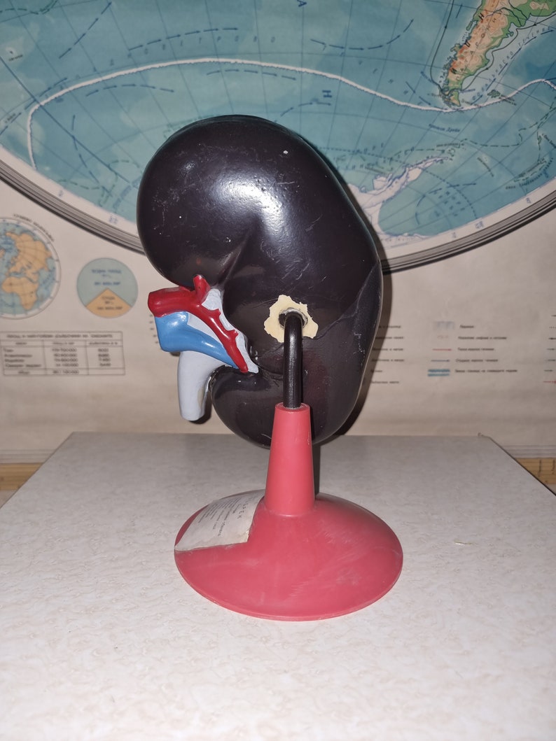 Vintage Anatomical Model of Human Kidney; Celluloid, Retro Medical ...