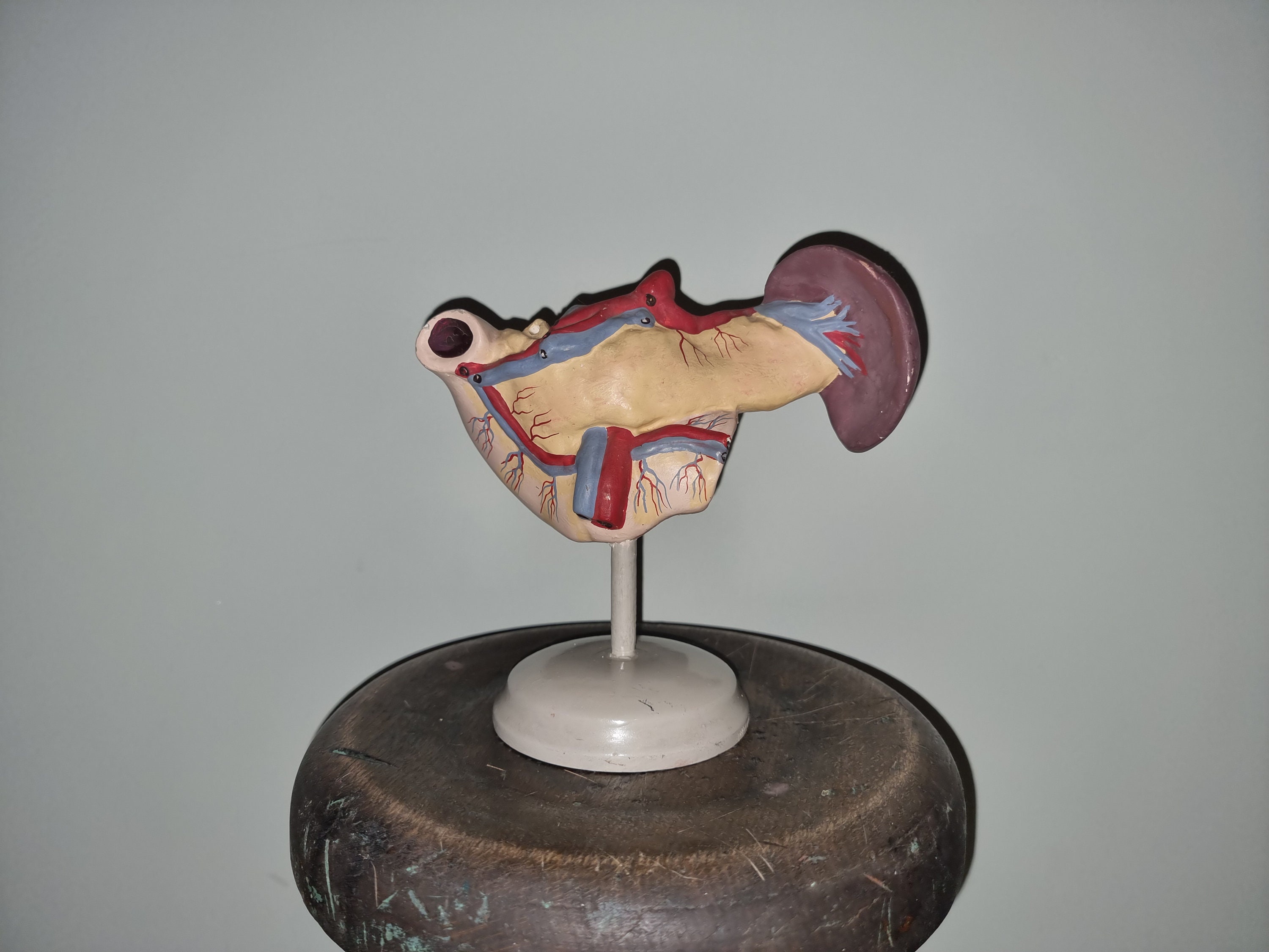 Vintage Anatomy Model of Pancreas - Etsy
