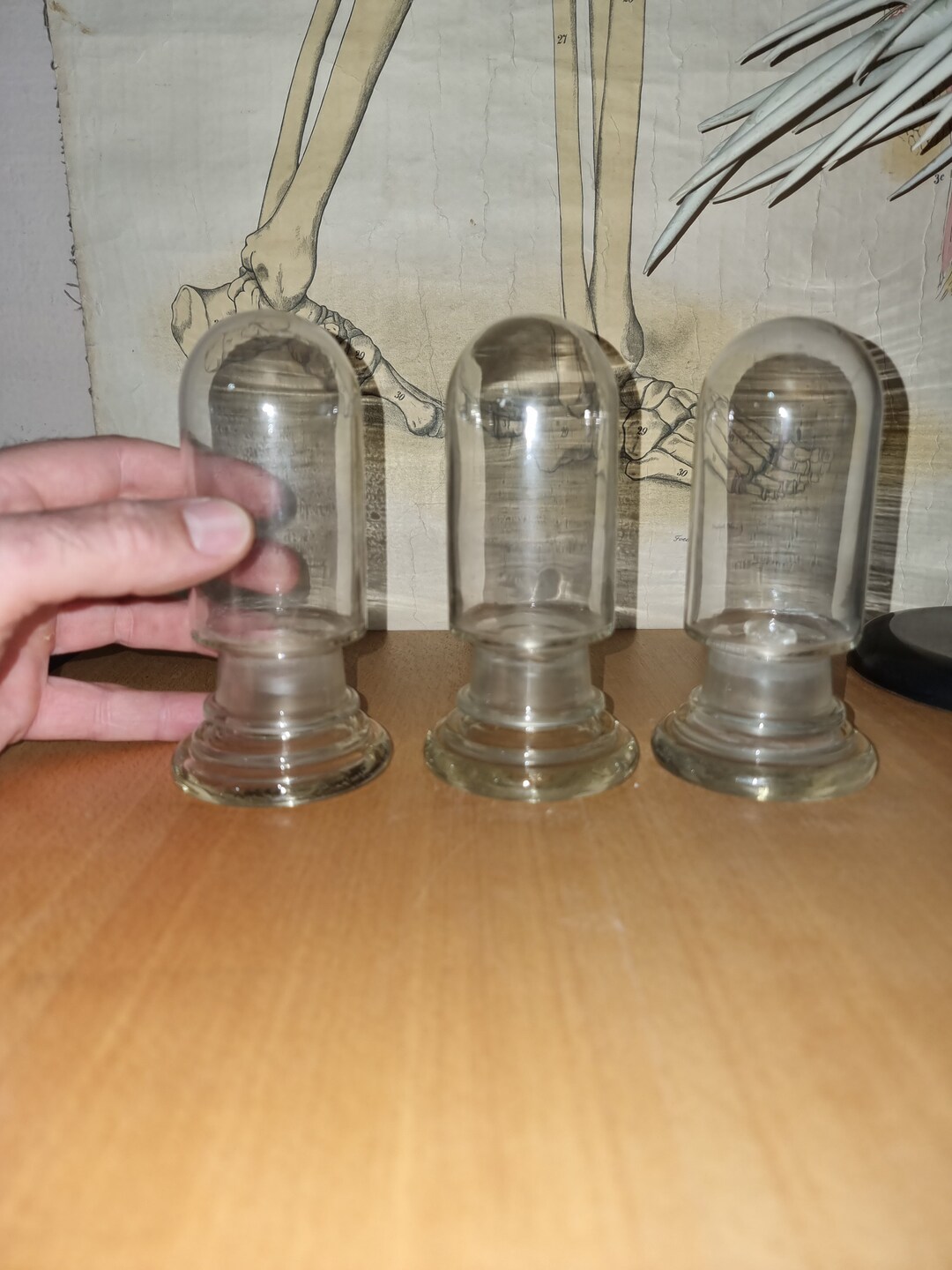 Flasks for a Chemical Laboratory. Glass Suction Cups. Interesting ...