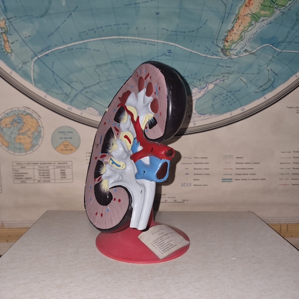 Anatomical Kidney Model - Etsy
