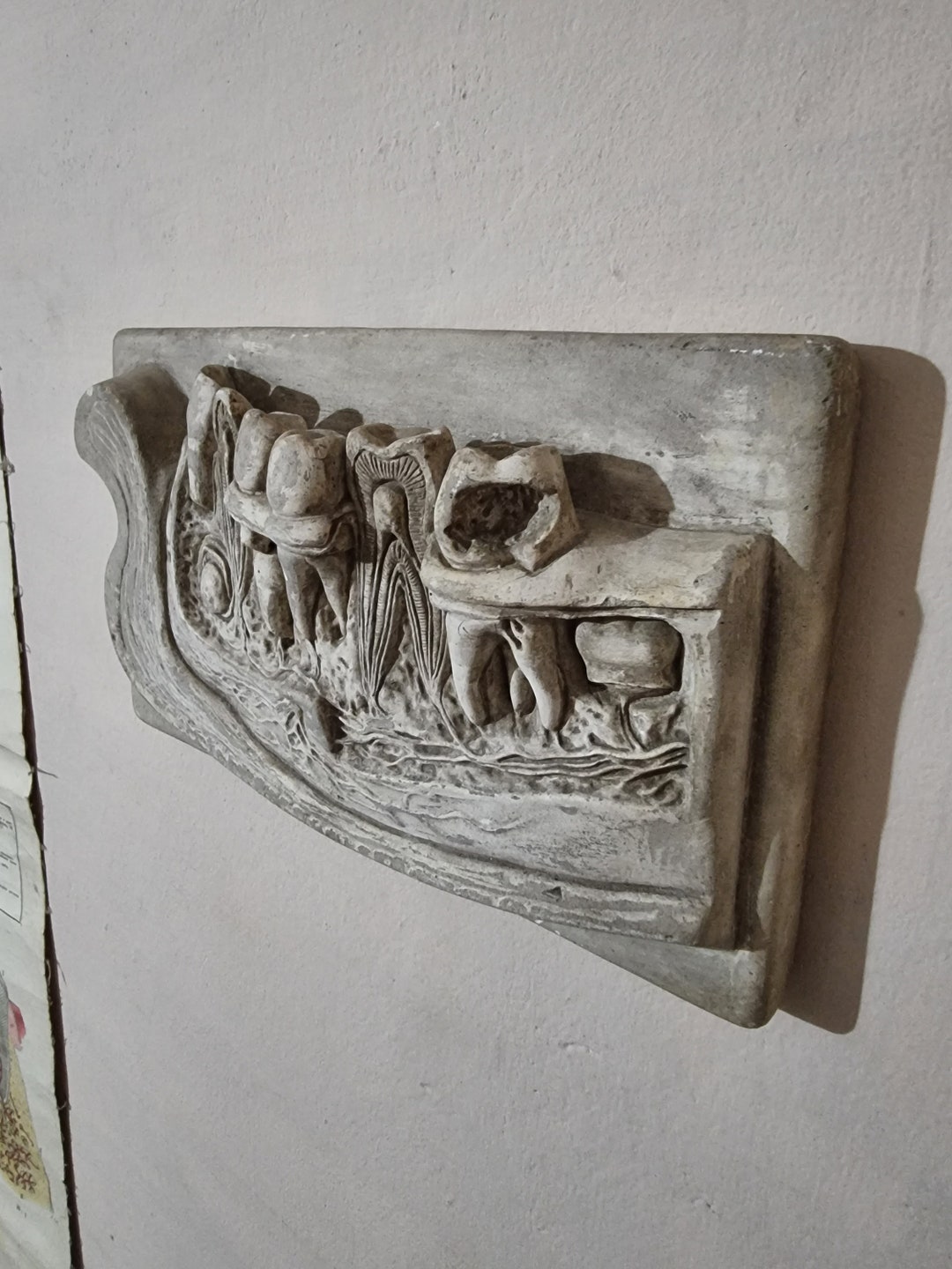 Antique Anatomy Model of Human Jaw, Teeth. Tooth Decay - Etsy